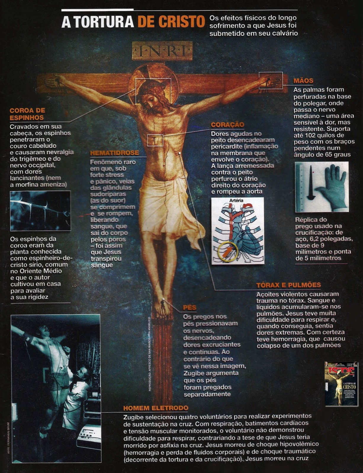 A crucificação de Jesus, no relato de médicos. – Blog Paracleto